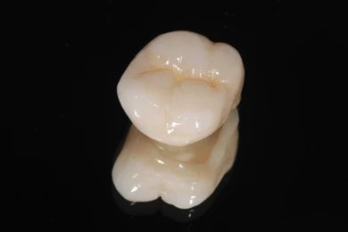 DL – Fixed Prosthesis – Easy Dent Dental | Website